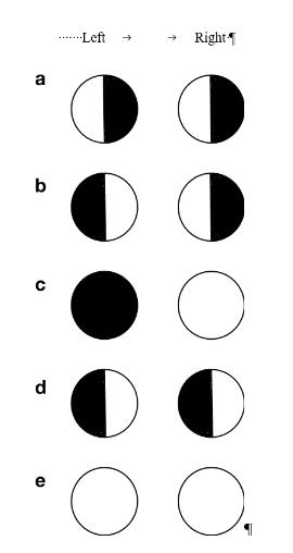 Solved Below are diagrams representing the visual fields | Chegg.com