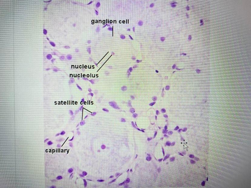 Multipolar Neuron Labeled Under Microscope