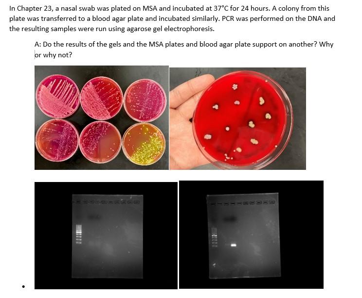 Solved In Chapter 23, a nasal swab was plated on MSA and | Chegg.com