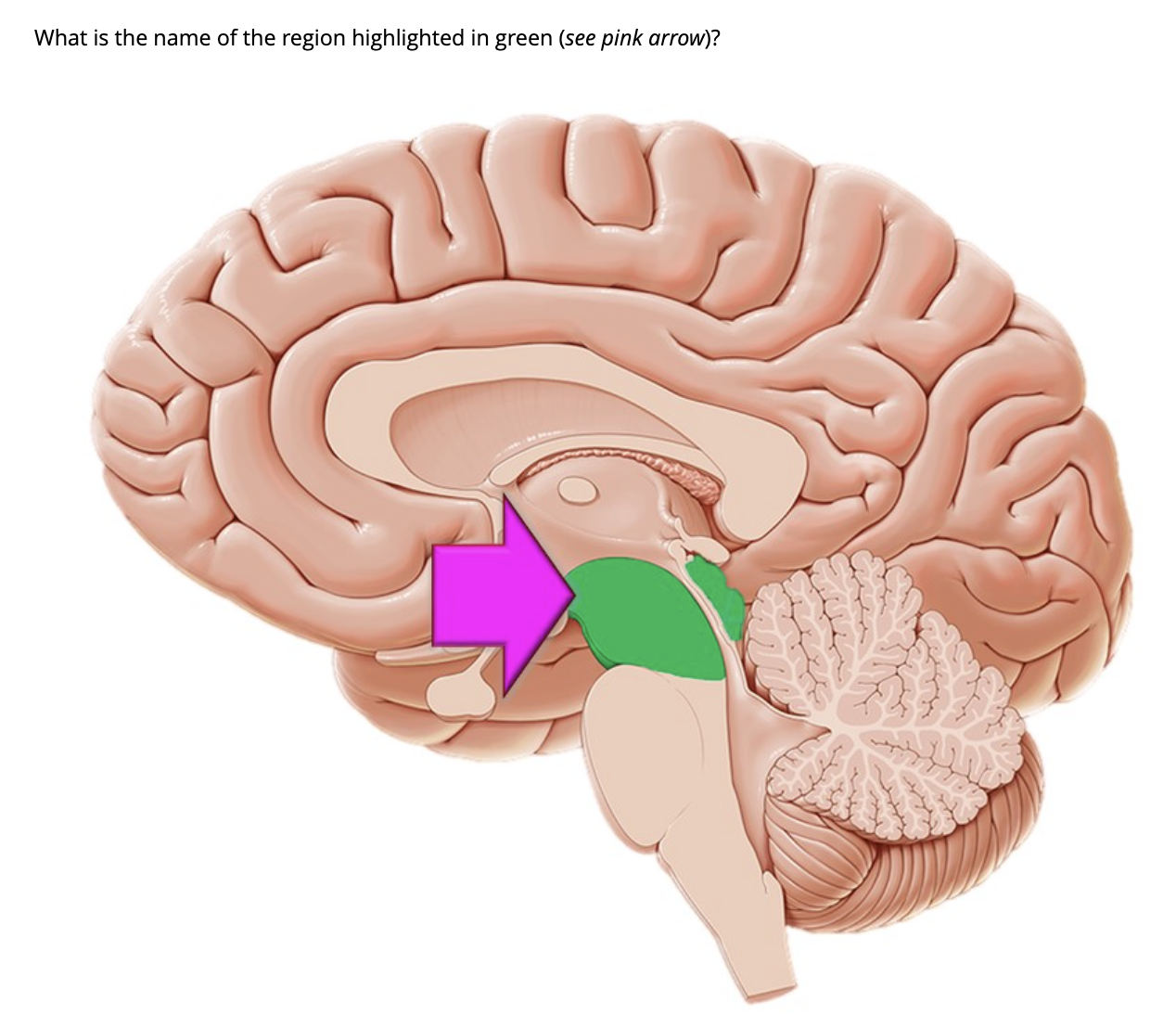 Solved What is the name of the region highlighted in green | Chegg.com