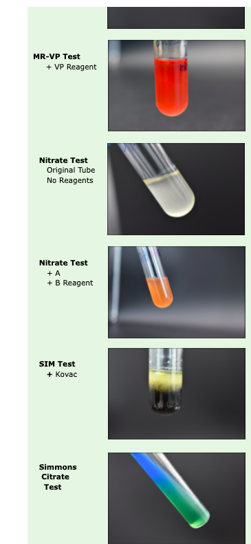 Solved Starch Agar + Iodine Blood Agar Catalase Test + | Chegg.com