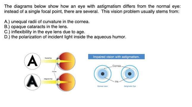 Solved The diagrams below show how an eye with astigmatism | Chegg.com