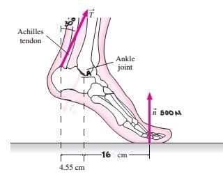 Solved 1.Draw the free body diagram (FBD) of the foot | Chegg.com