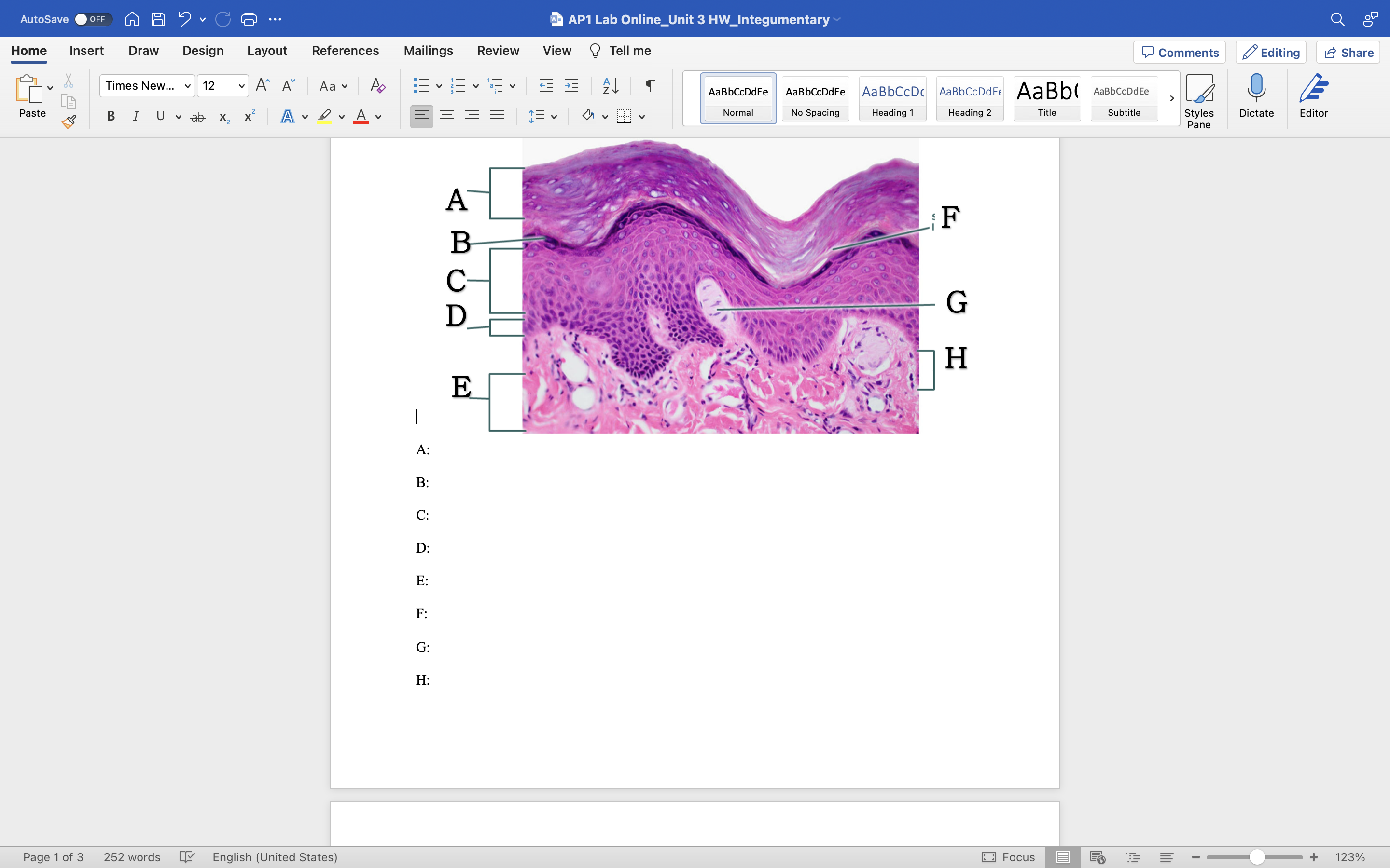 Solved art A: Skin Histology: Please label the skin layers | Chegg.com