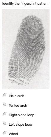 Solved Identify the fingerprint pattern. O Plain arch Tented | Chegg.com