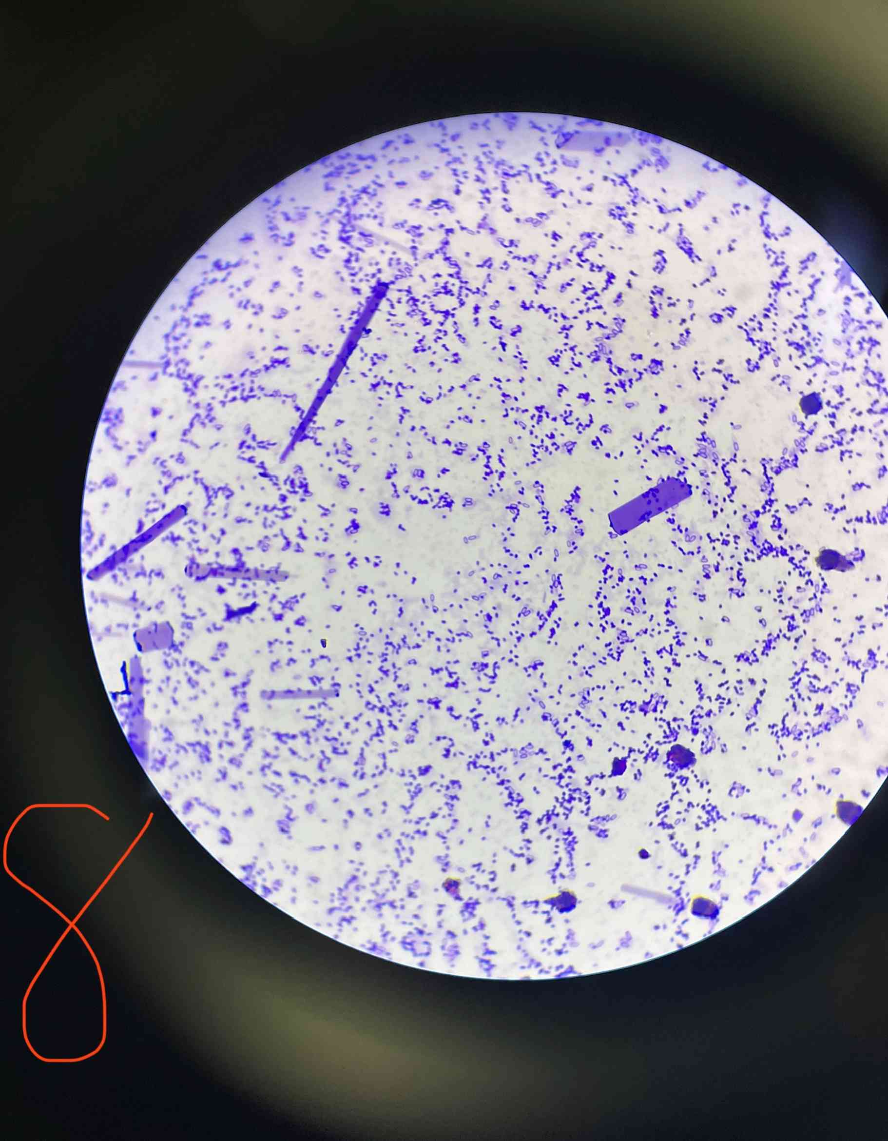 Solved what is the cell morphology in this slide? | Chegg.com
