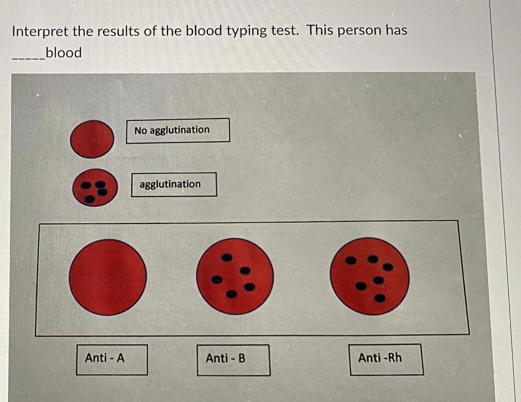 Solved Interpret the results of the blood typing test. This | Chegg.com