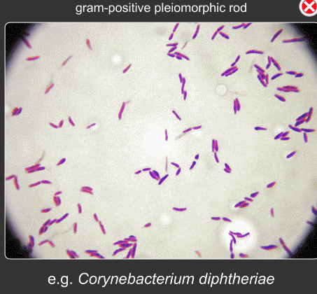 Corynebacterium Gram Stain