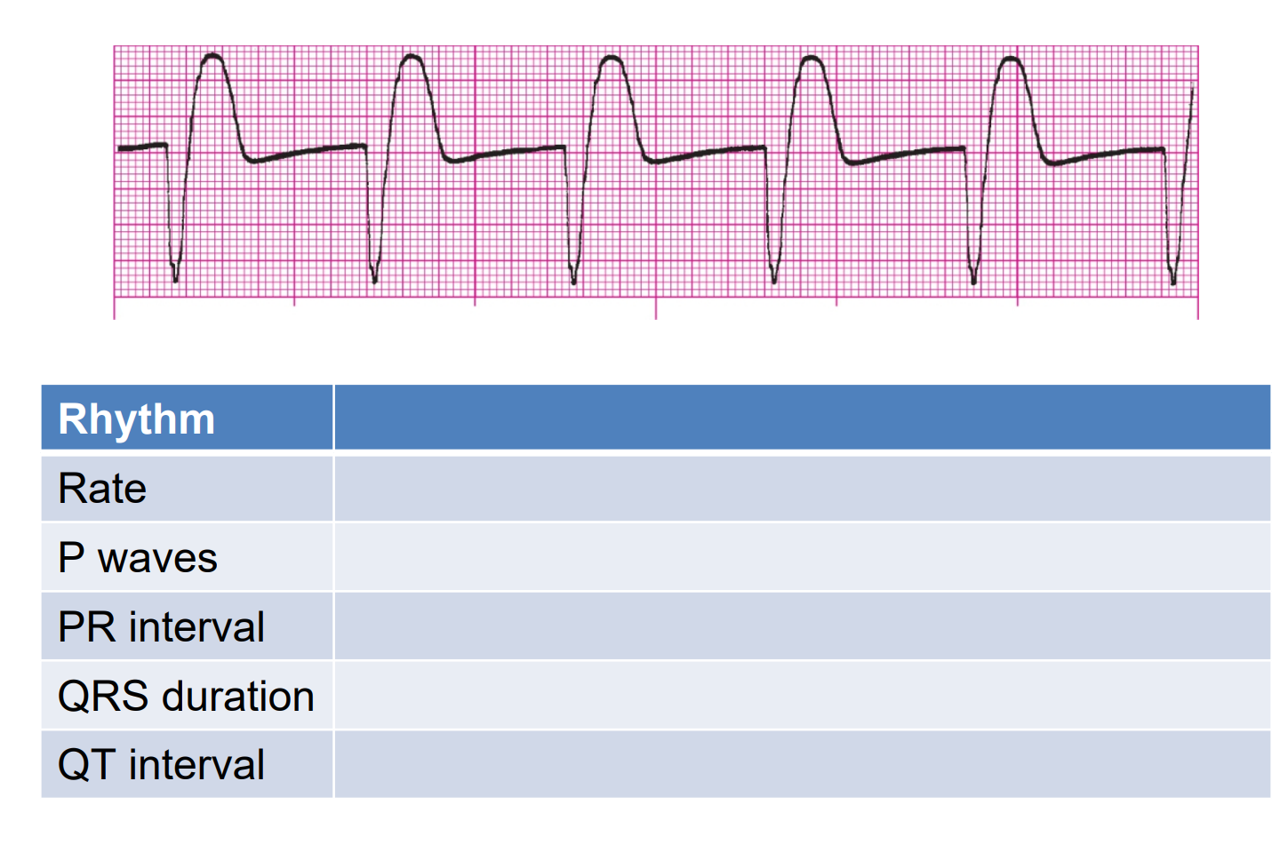 Solved Hi. Can you please show me how to interpret the Rate, | Chegg.com