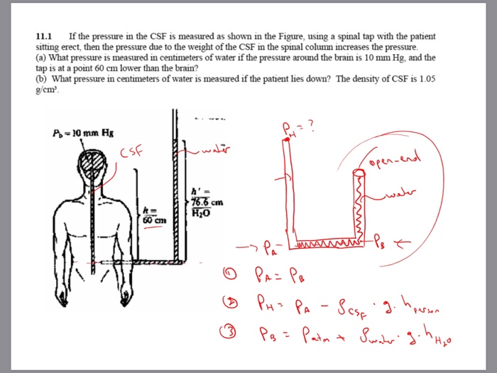 Solved 11.1 If the pressure in the CSF is measured as shown | Chegg.com