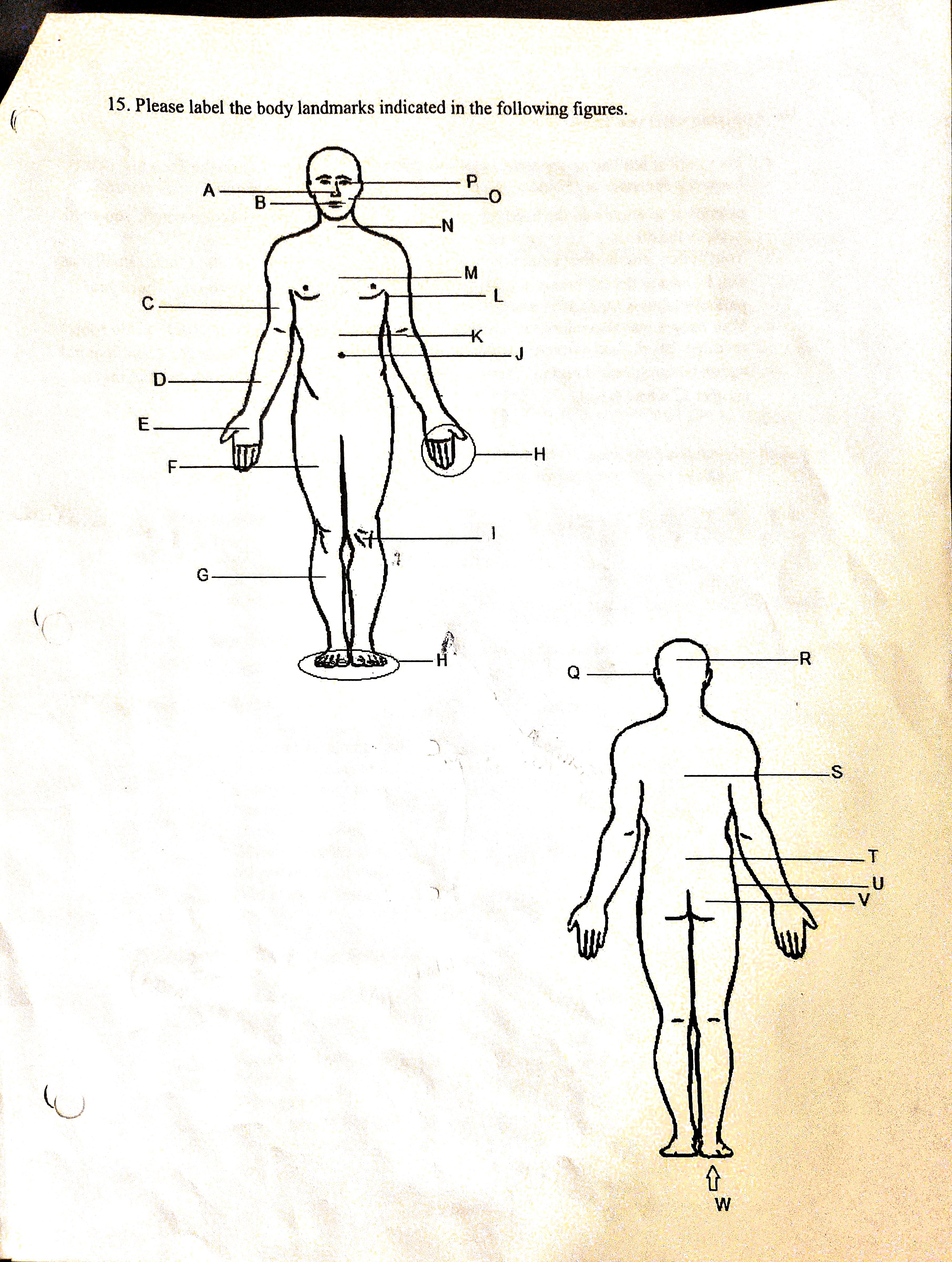 Solved 15. Please label the body landmarks indicated in the | Chegg.com