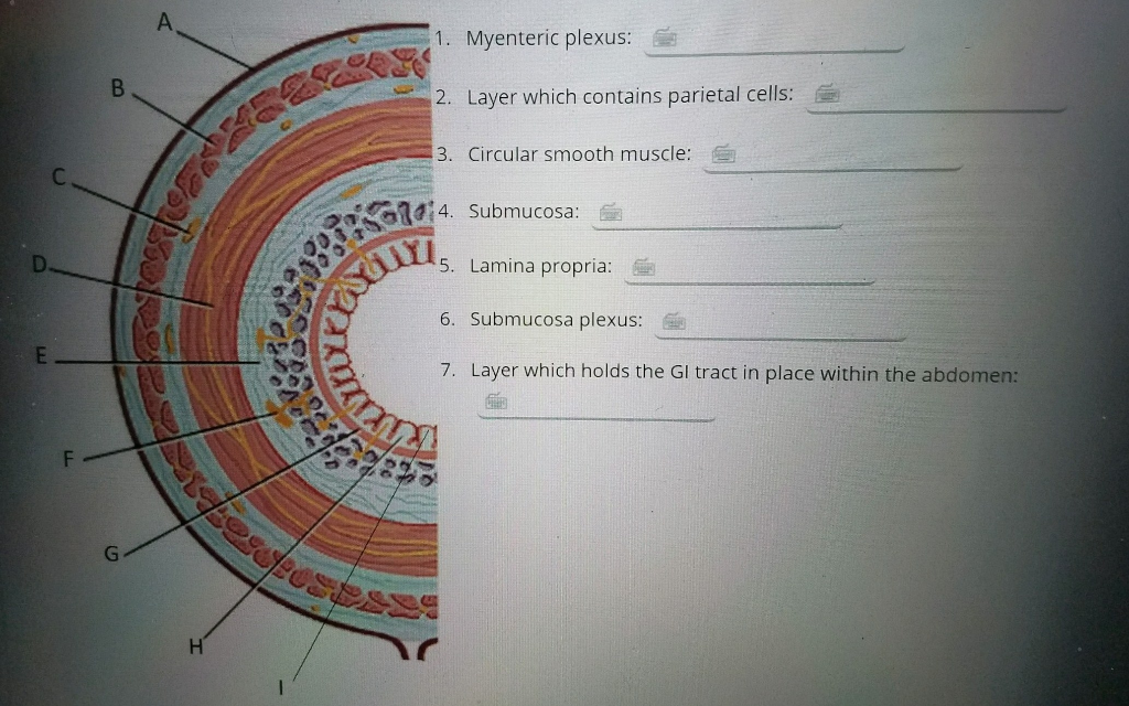 Solved 1. Myenteric plexus: 2. Layer which contains parietal | Chegg.com