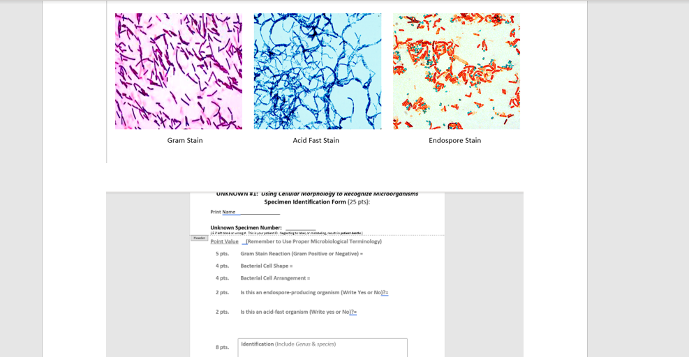 Solved Gram Stain Acid Fast Stain Endospore Stain UNKNOWN | Chegg.com