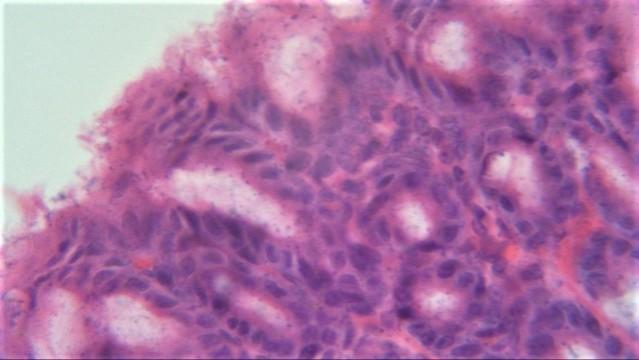 Solved From the Stomach (simple columnar): Recognize slide | Chegg.com