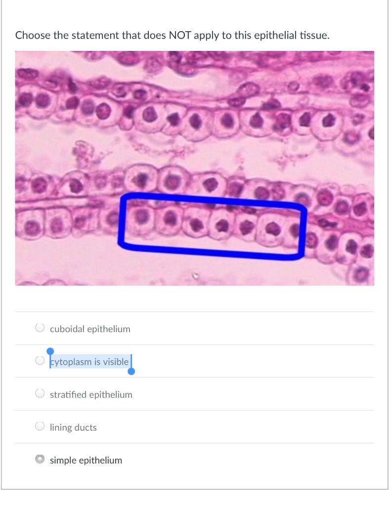Solved Choose the statement that does NOT apply to this | Chegg.com