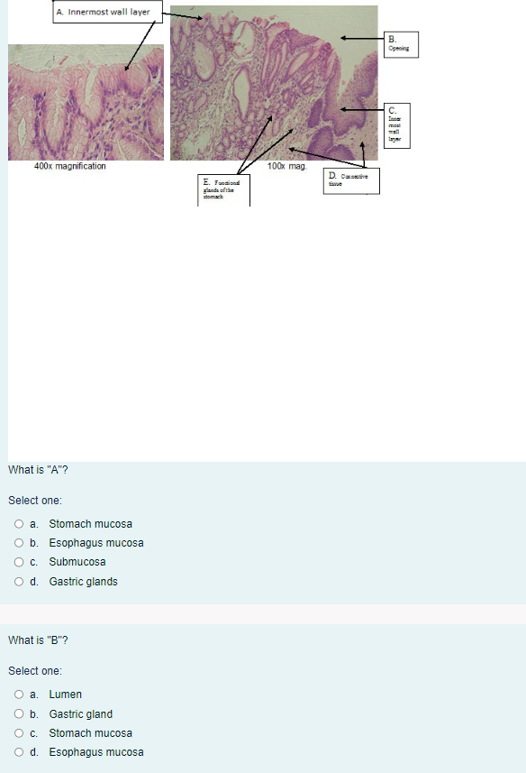 Solved a. Stomach mucosa b. Esophagus mucosa c. Submucosa d. | Chegg.com