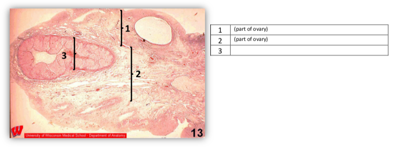 Solved Identify the numbered structures below in the | Chegg.com