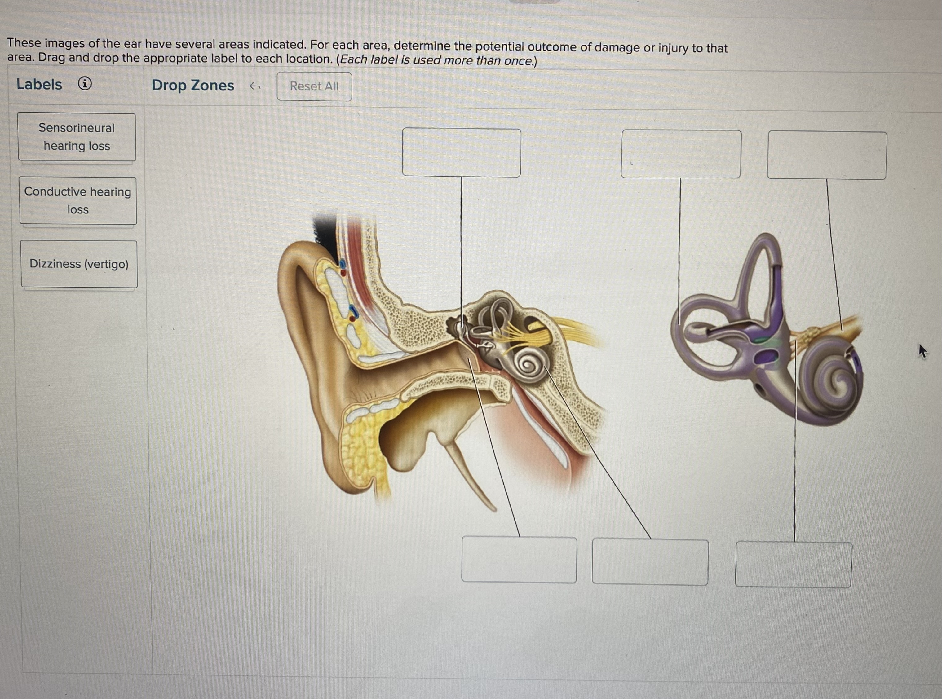 Solved These images of the ear have several areas indicated. | Chegg.com