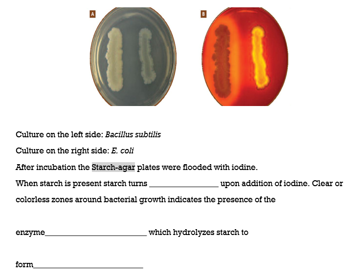 Solved B Culture on the left side: Bacillus subtilis Culture | Chegg.com