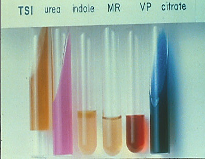 Solved TSI urea indole MRVP citrate | Chegg.com