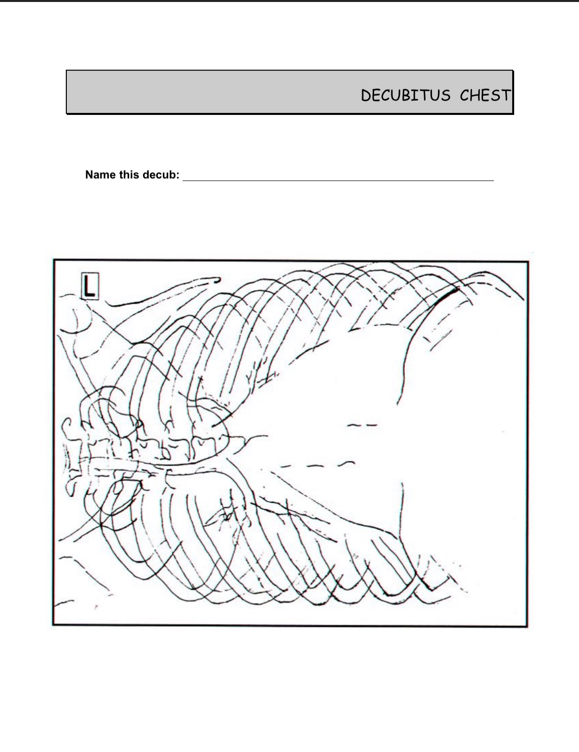 Solved Decubitus chest - ﻿name the decub (be specific); if | Chegg.com