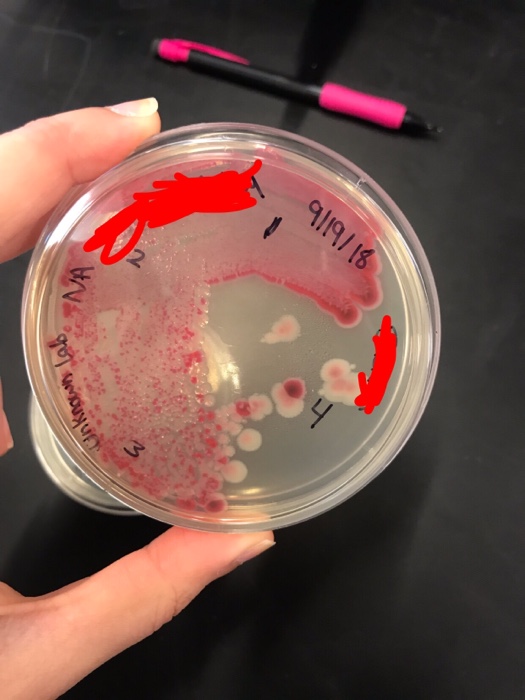 Solved Identify the two bacteria strains on this agar plate. | Chegg.com
