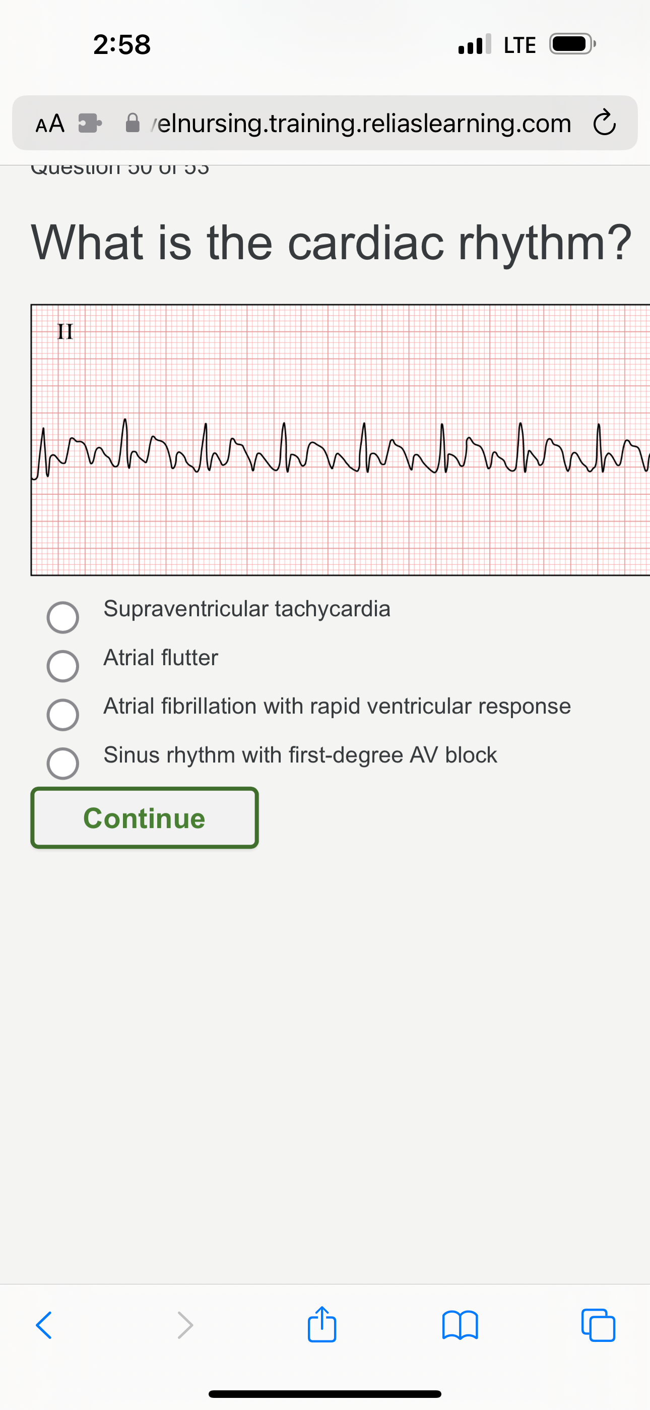 Solved What is the cardiac rhythm?Supraventricular | Chegg.com