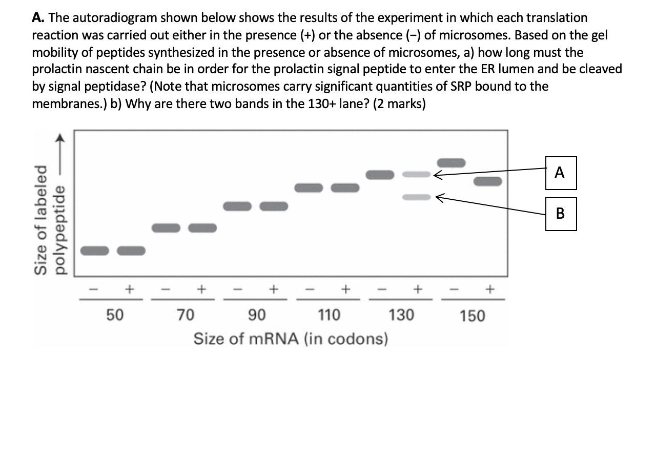 Solved A. The autoradiogram shown below shows the results of | Chegg.com