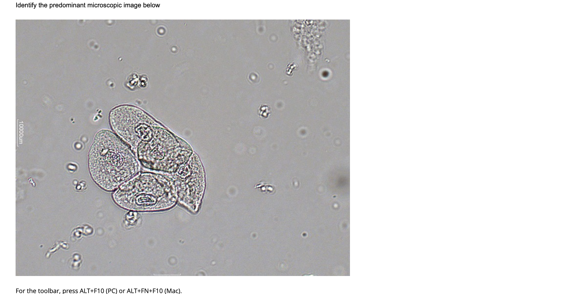 Solved Identify the predominant microscopic image | Chegg.com