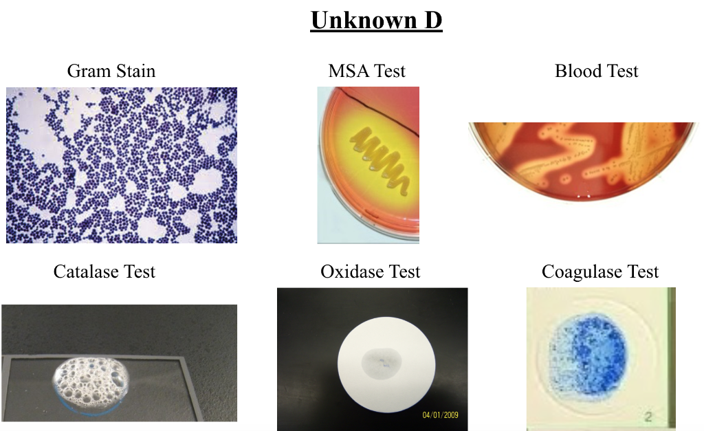 Solved Unknown C Gram Stain MSA Test Blood Test 20 m | Chegg.com