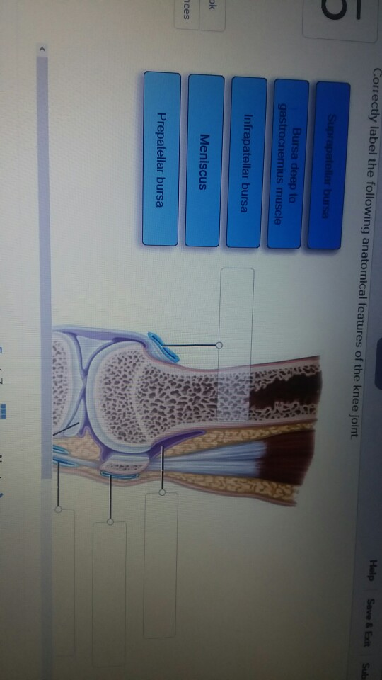 Solved Correctly label the following anatomical features of | Chegg.com