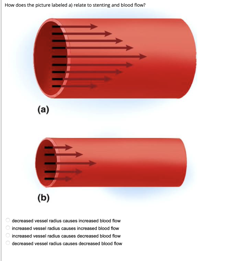 Solved How does the picture labeled a) relate to stenting | Chegg.com