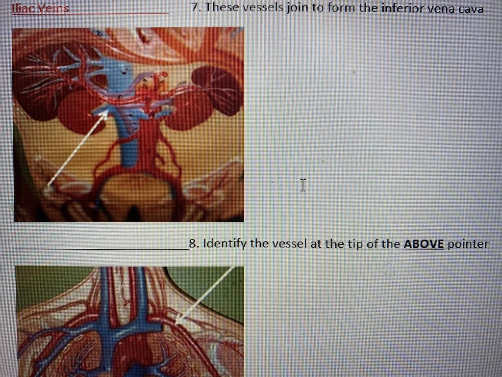 Solved . Identify the vessel at the tip of the ABOVE pointer | Chegg.com