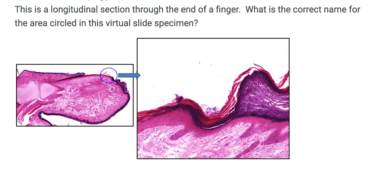 Solved What is the name of the area circled in the slide | Chegg.com