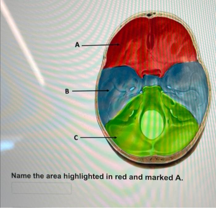 Solved A B - C- Name the area highlighted in red and marked | Chegg.com