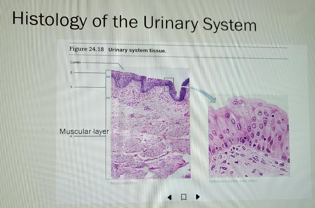 Solved Histology of the Urinary System | Chegg.com