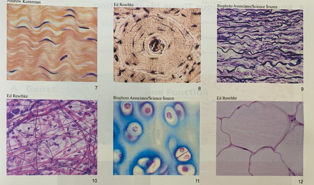 Solved Identify the epithelia (1 -6) and connective tissue | Chegg.com
