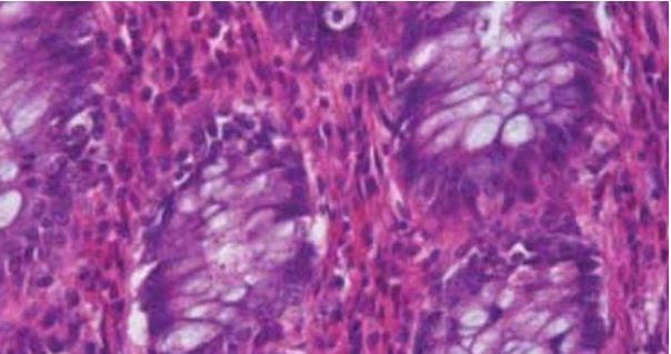 Solved This is a pathology question. 1. Describe the errors | Chegg.com