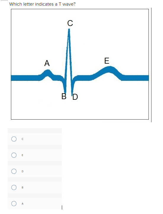 Solved Which letter indicates a T wave? С A E BD O E B од | | Chegg.com