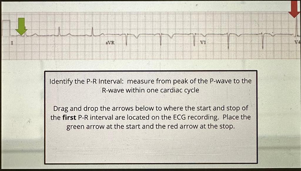 Identify the P-R Interval: measure from peak of the | Chegg.com
