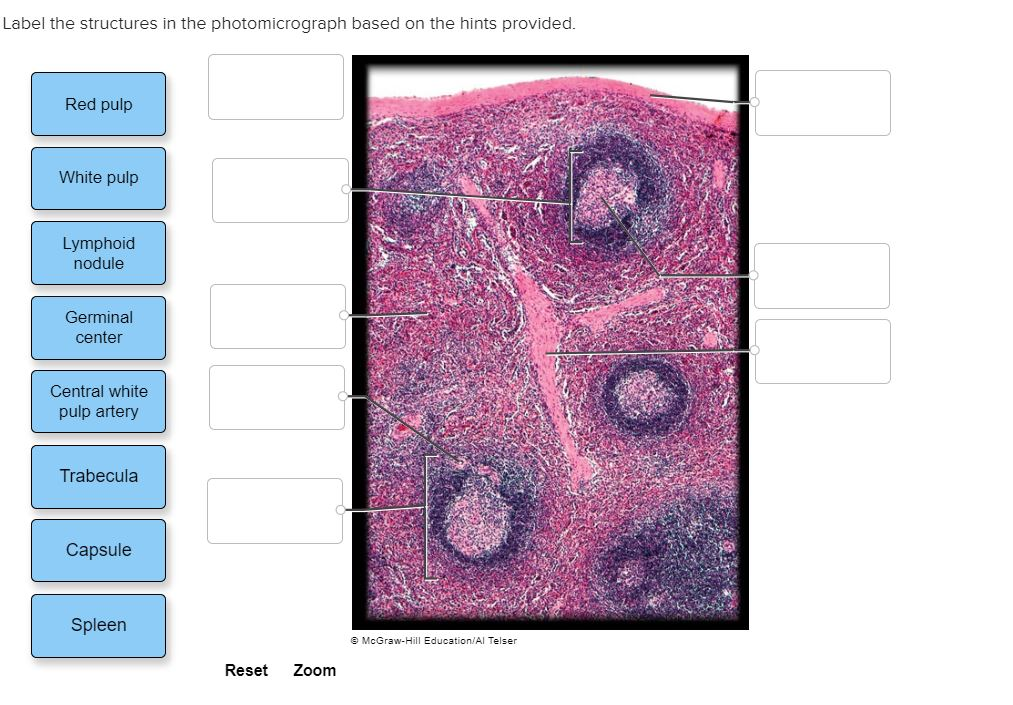 Solved: Label The Structures In The Photomicrograph Based ... | Chegg.com