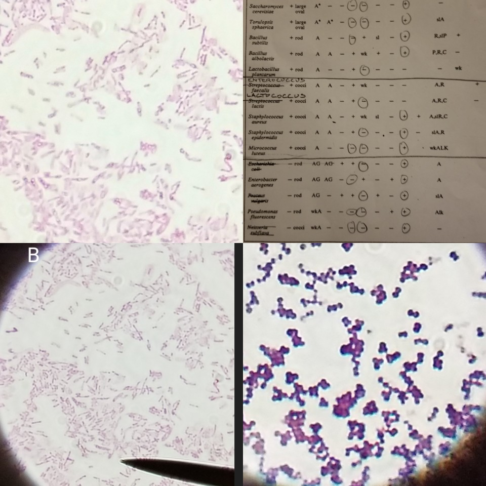 Solved Identification of Unknown Microbes. I'm pretty sure | Chegg.com