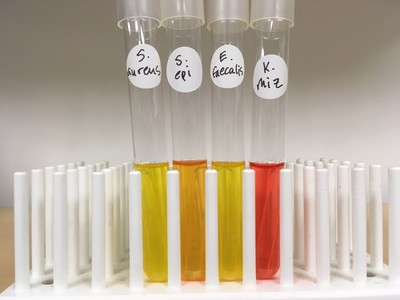 Phenol red carbohydrate broth Key to symbols and | Chegg.com