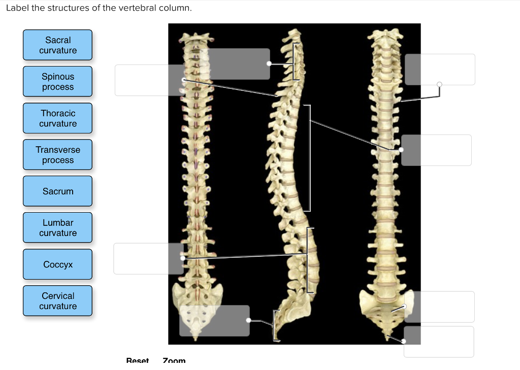 Solved Label The Structures Of The Vertebral Column Sacral Chegg