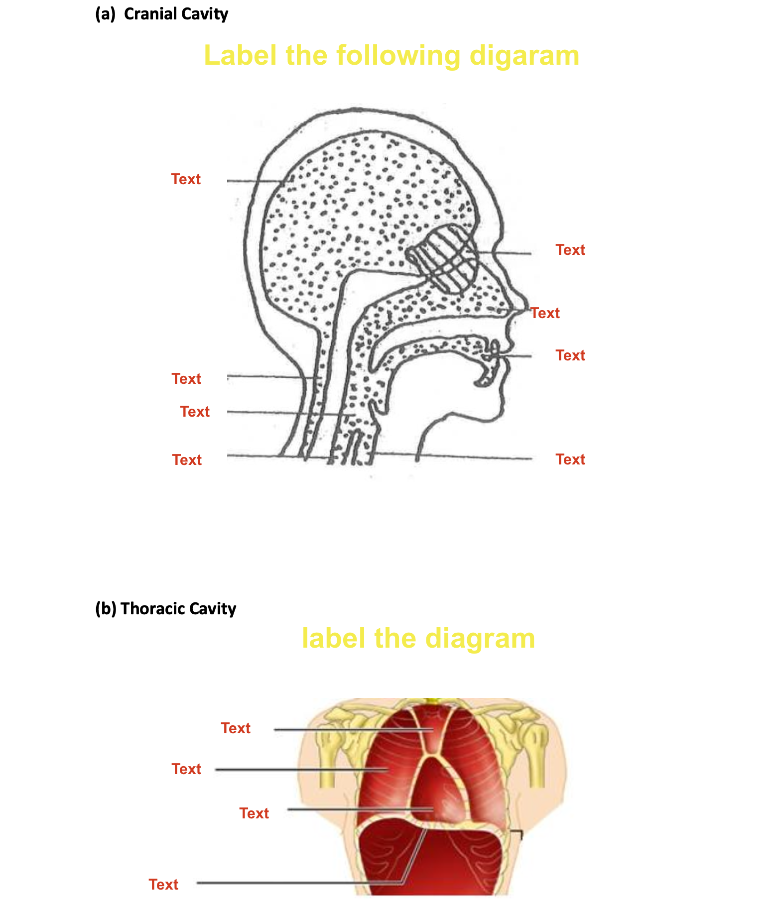 Solved Label the following digaram (b) Thoracic Cavity | Chegg.com