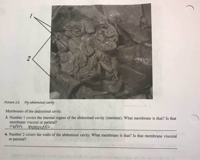 Solved Picture 52 rig abdominal cavity Membranes of the | Chegg.com