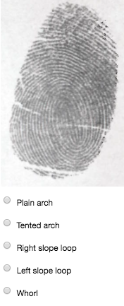 Solved Identify the fingerprint pattern. O Plain arch Tented | Chegg.com
