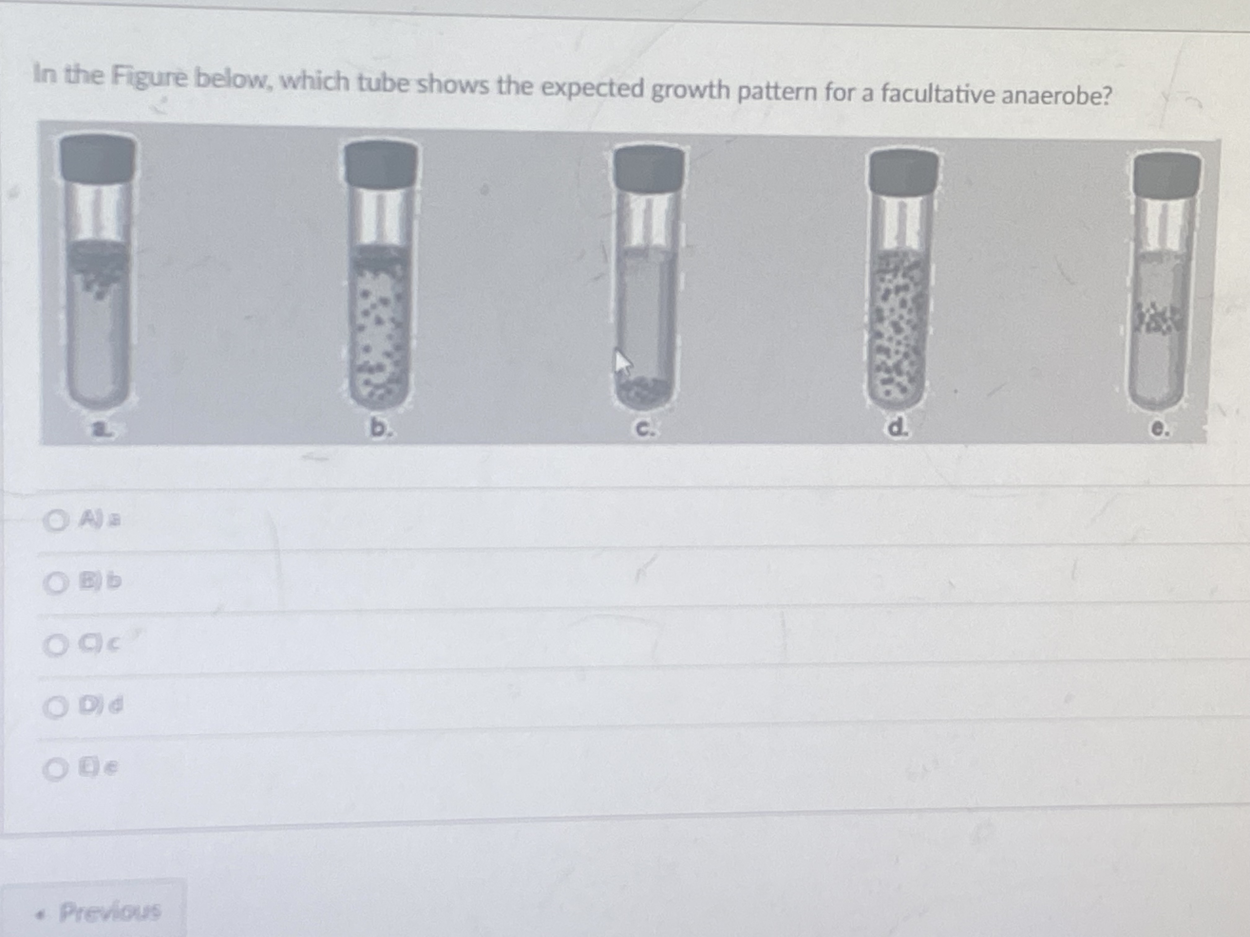 Solved in the figure below, which tube shows the expected | Chegg.com
