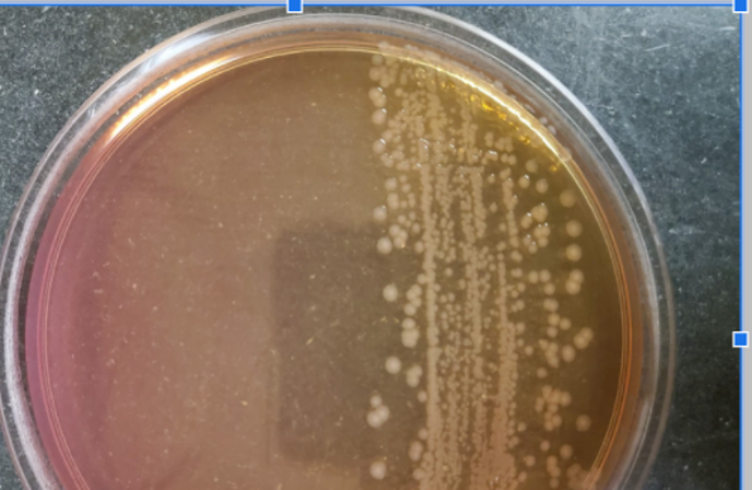 Solved Biochemical Test results Gram positive or gram | Chegg.com