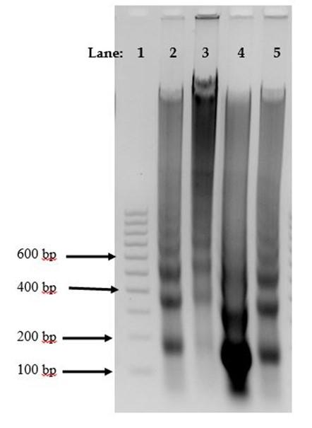Solved On the gel, label a band that contains DNA fragments | Chegg.com